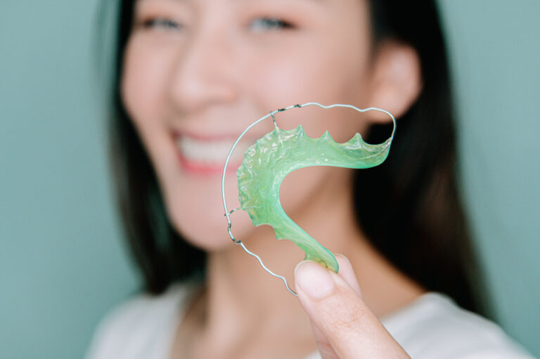 How Long Can You Skip Retainer Wear? ARCH Orthodontics Tips